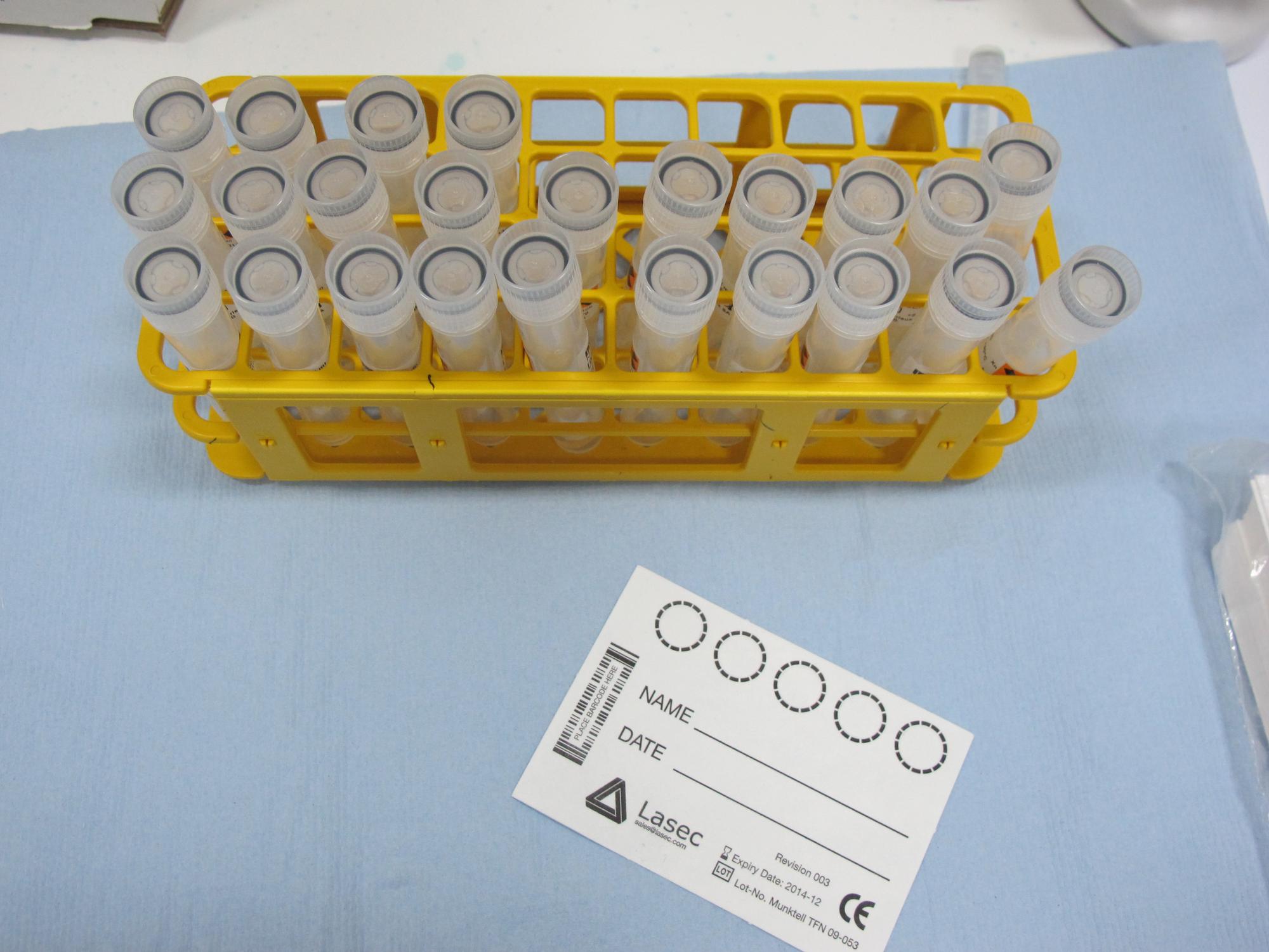 We need a revolution in the delivery of care to beat HIV/Aids | MSF